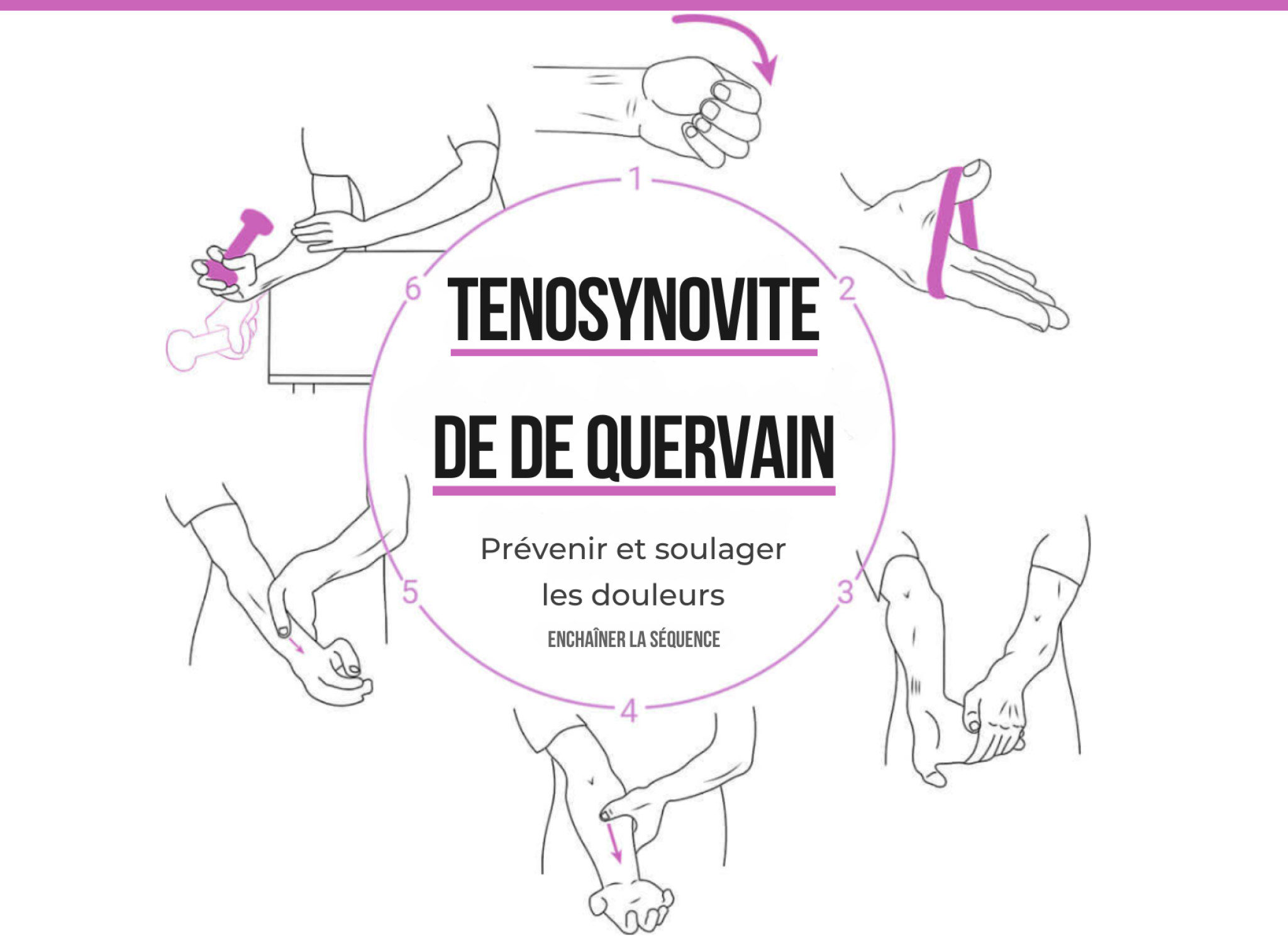 Tendinite de De Quervain : Arrêt de Travail et le Temps de Guérison ...
